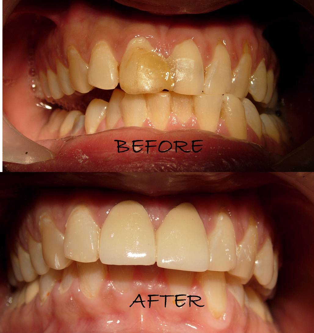 Noida Dental Centre | Dr. Anshul Singhal - Expert Oral & Maxillofacial ...